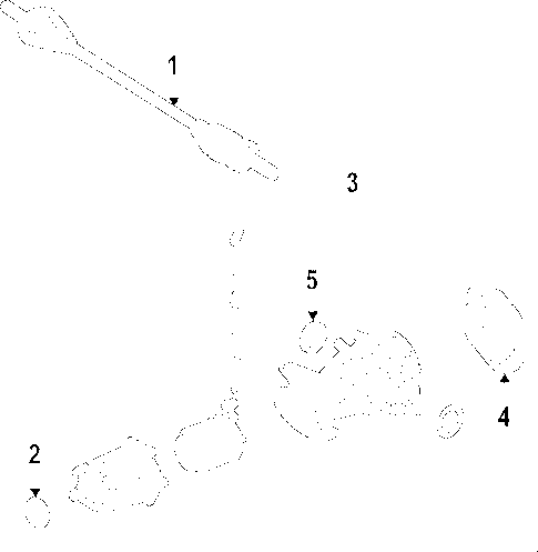Differential for 2014 Lincoln MKX | QuirkParts